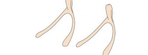 Wishbone Cut Out – Medium